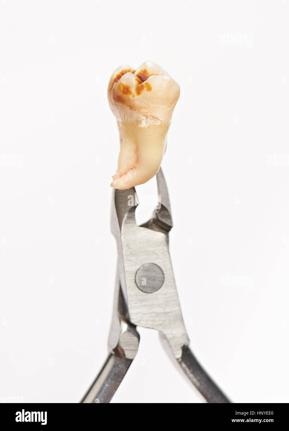 Surgery Closeup of extracted teeth isolated on white background Stock ...