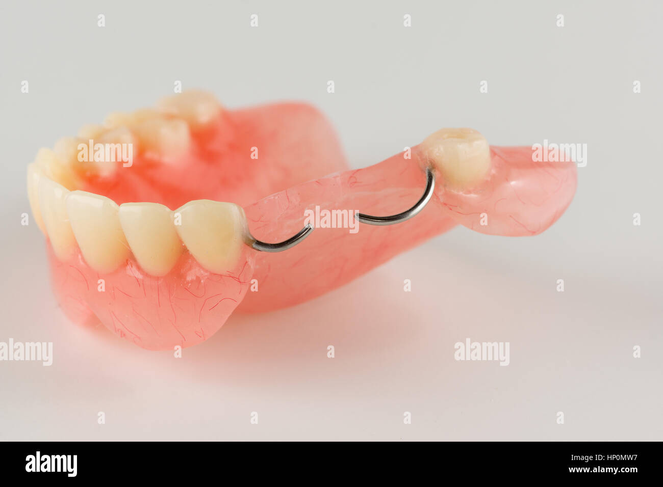 acrylic denture with metal clasps for restoring dentition Stock Photo ...