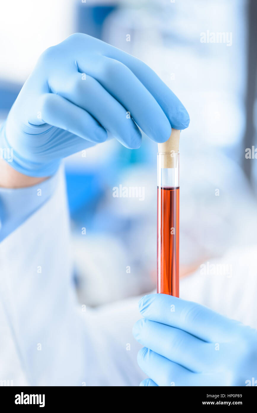 Test latex reagent hi-res stock photography and images - Alamy