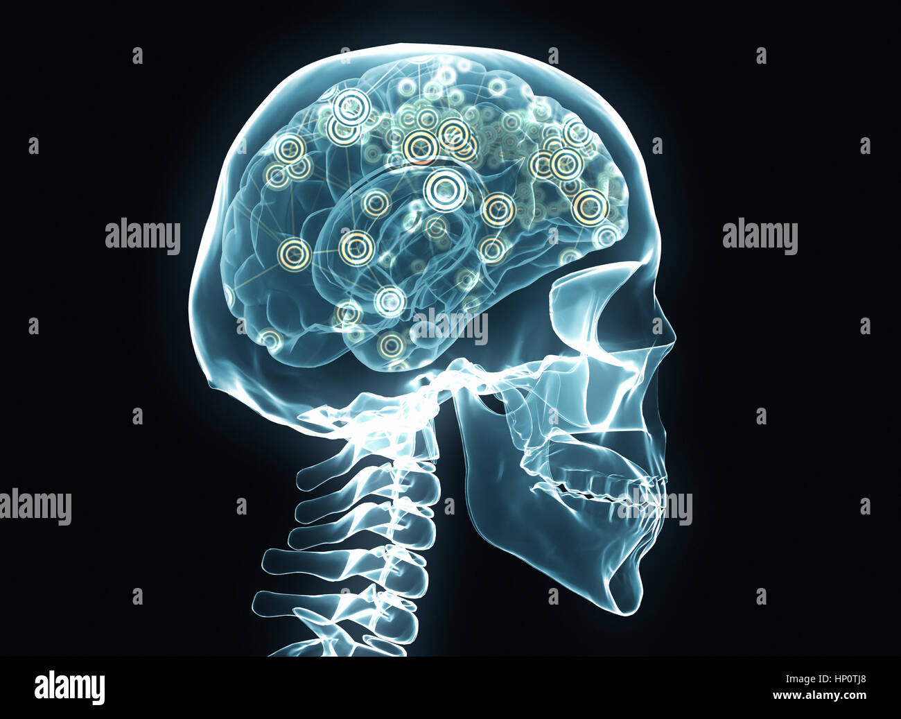 X-ray brain and skeleton isolated on black network Stock Photo - Alamy