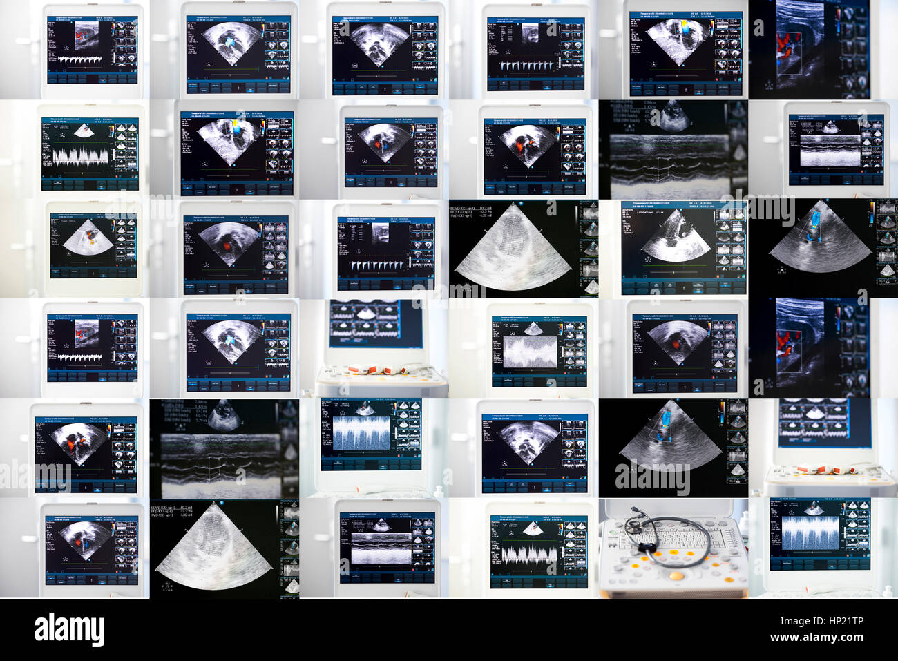 a collage of images of the ultrasound screen with heart studying Stock ...