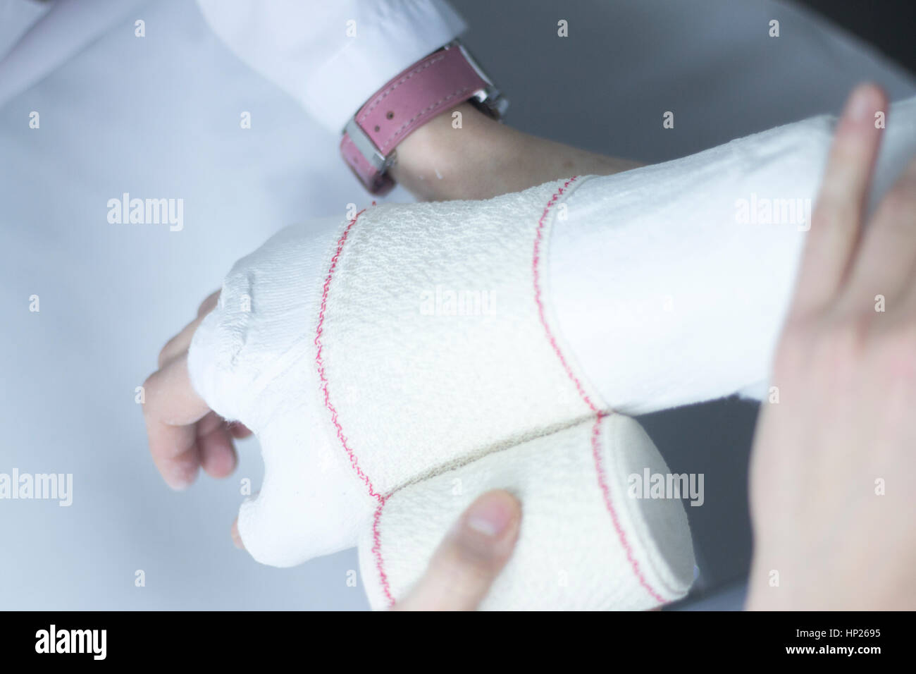 Doctor applying a plaster cast and bandages to patient forearm and ...