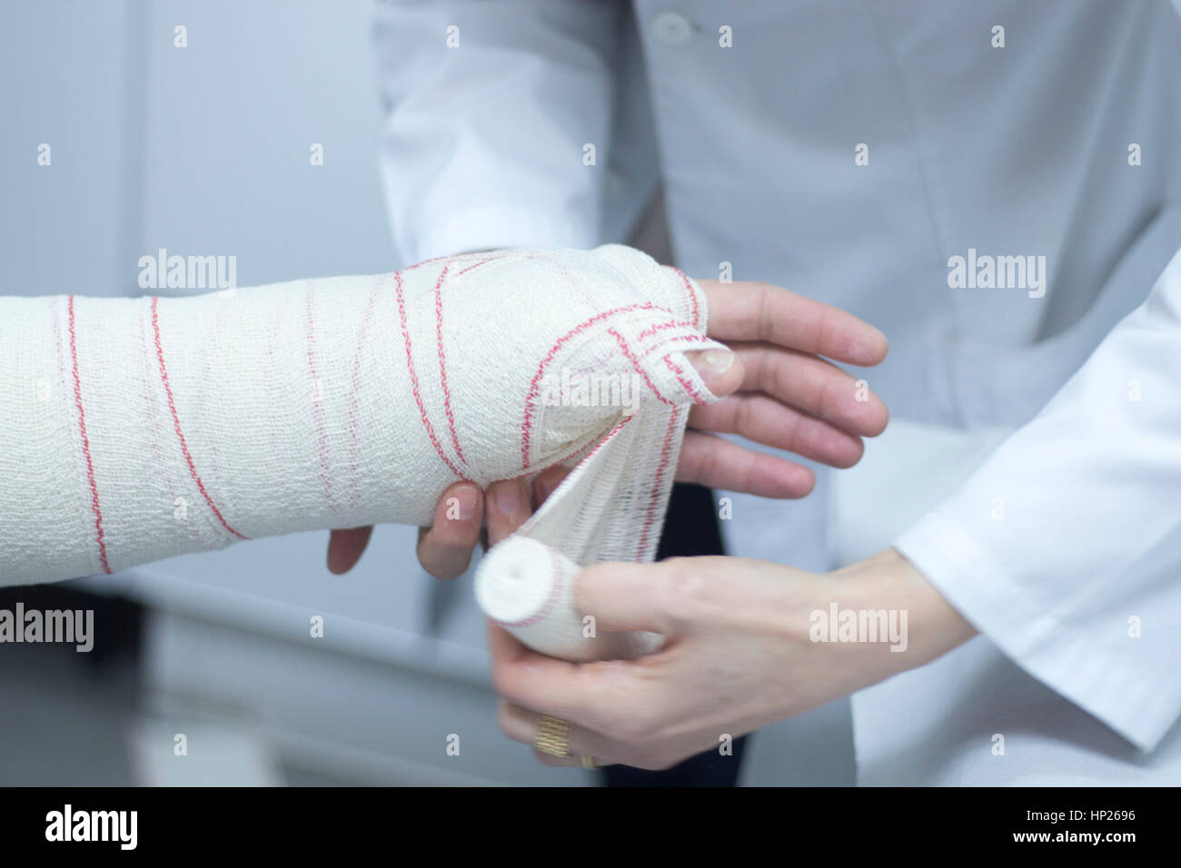 Doctor applying a plaster cast and bandages to patient forearm and ...