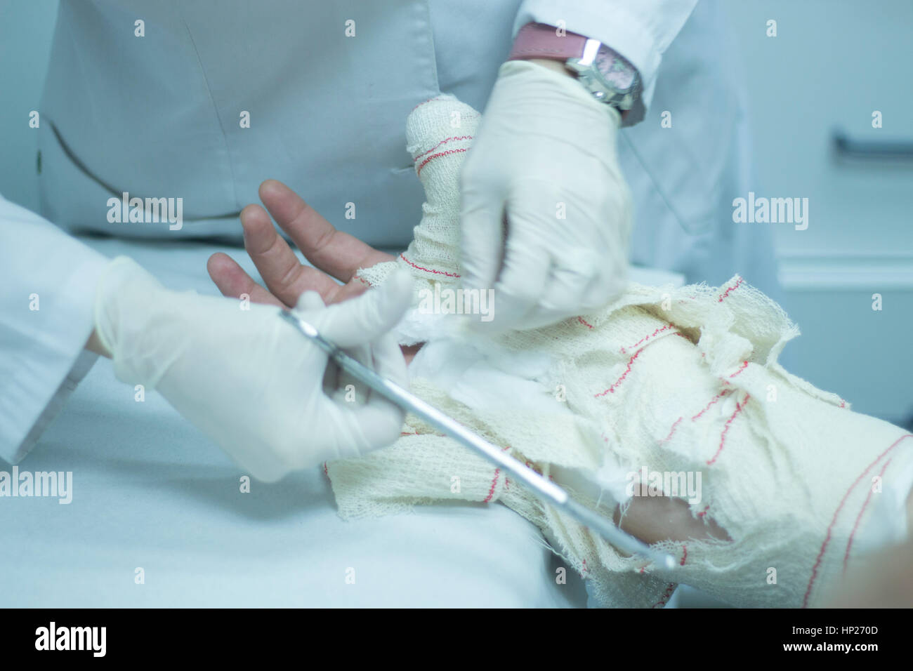 Doctor removing a plaster cast and bandages to patient forearm and ...