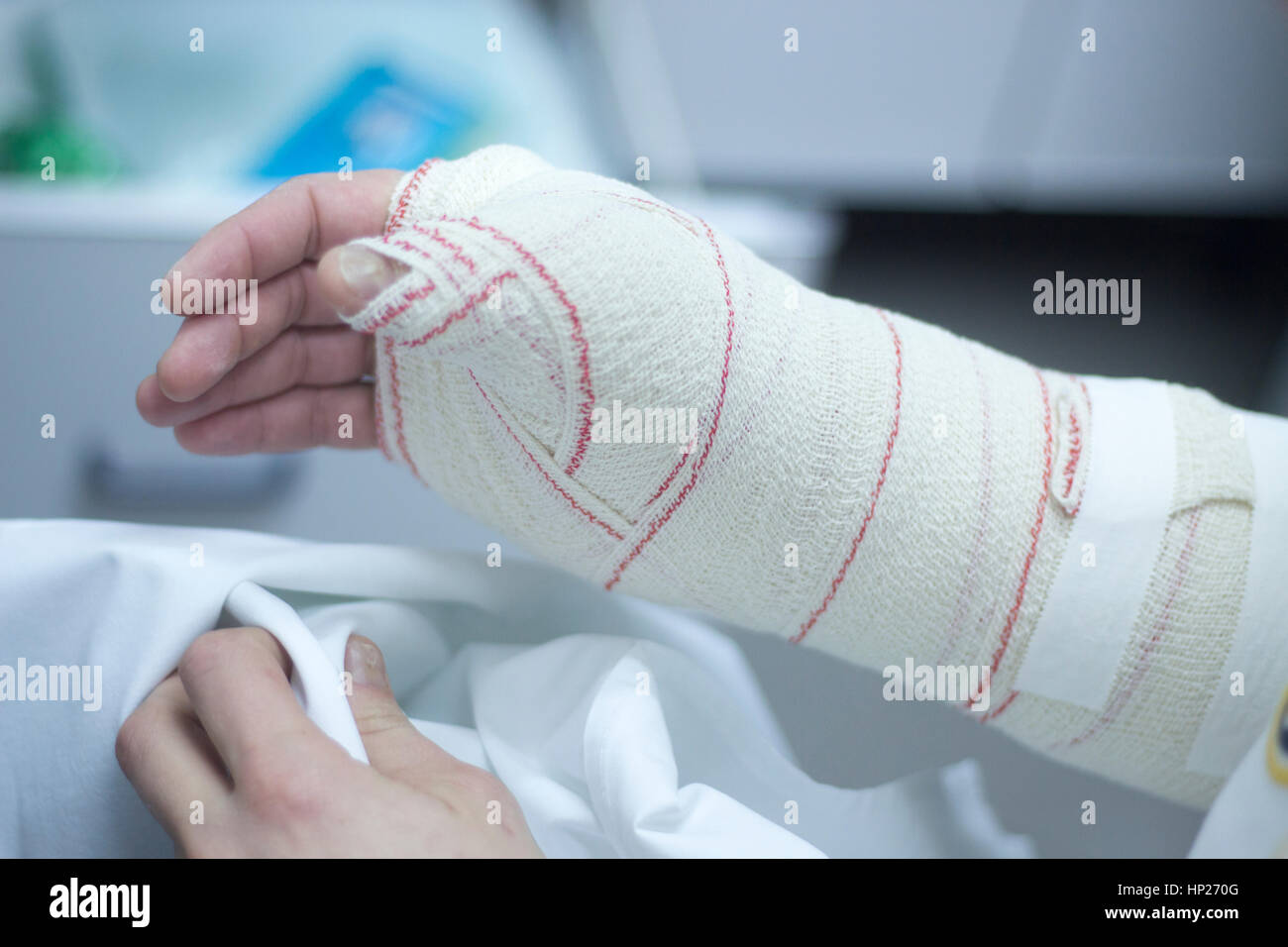 Doctor applying a plaster cast and bandages to patient forearm and ...