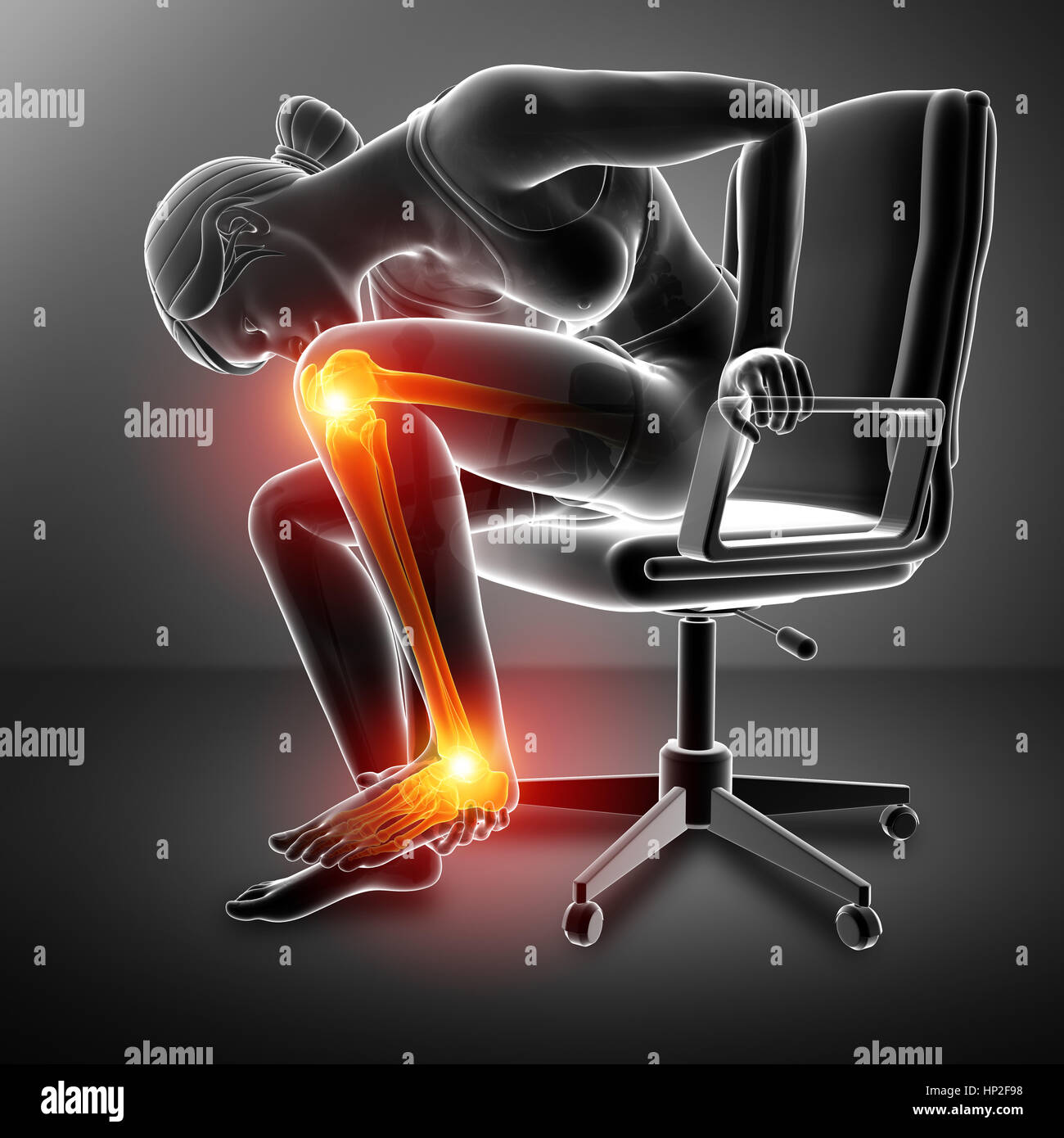 3d illustration of Pain in leg Stock Photo - Alamy
