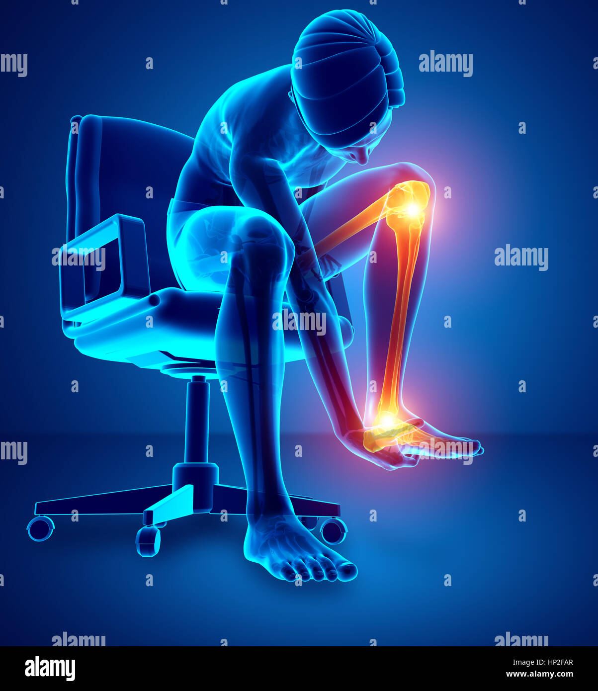 3d Illustration of Pain in leg Stock Photo - Alamy