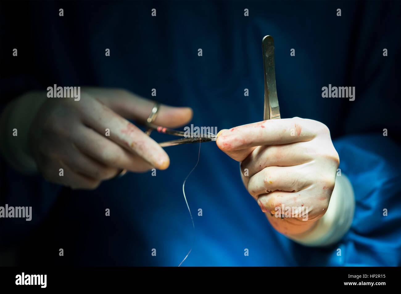 Medical Stitches Hand High Resolution Stock Photography and Images - Alamy