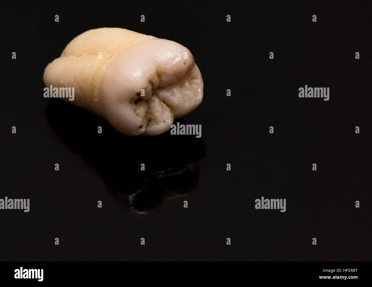 close-up of human tooth on a black background Stock Photo - Alamy