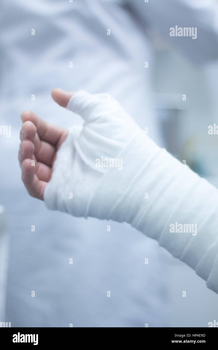 Doctor applying a plaster cast and bandages to patient forearm and ...