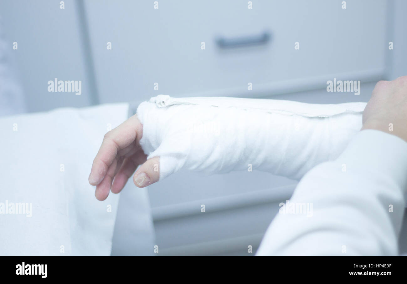 Doctor applying a plaster cast and bandages to patient forearm and ...