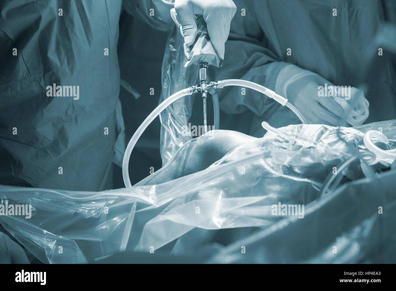 Knee keyhole surgery hospital arthroscopy operation medical procedure ...