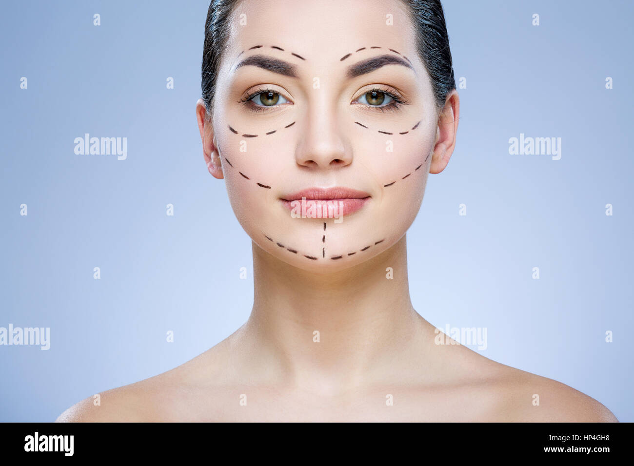 Perforation lines on patient's face Stock Photo - Alamy