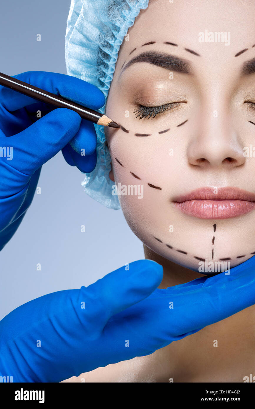 Perforation lines on patient's face Stock Photo - Alamy