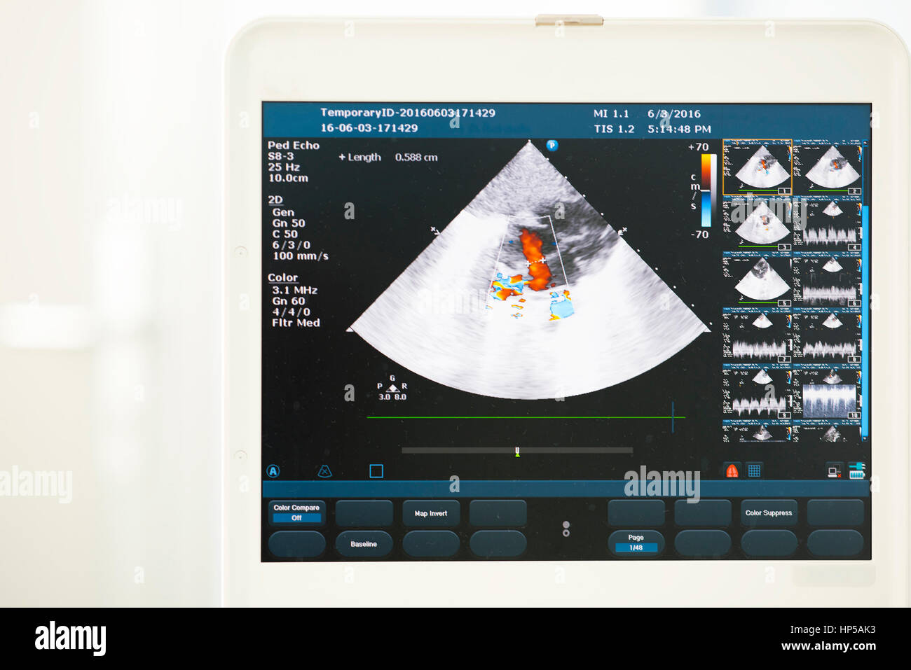 ultrasound scanner screen Stock Photo - Alamy