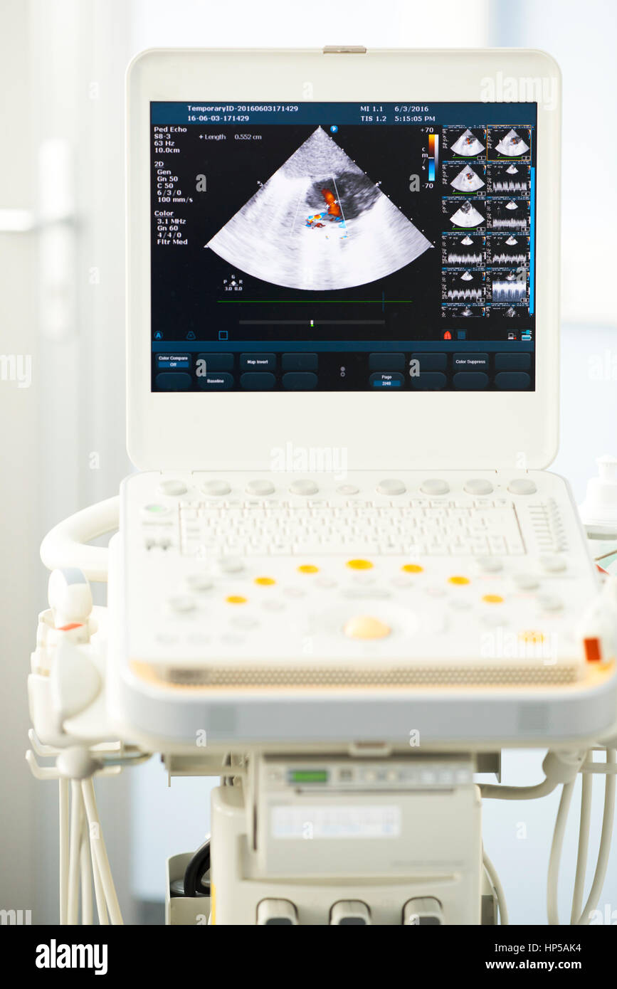 ultrasound scanner screen Stock Photo - Alamy