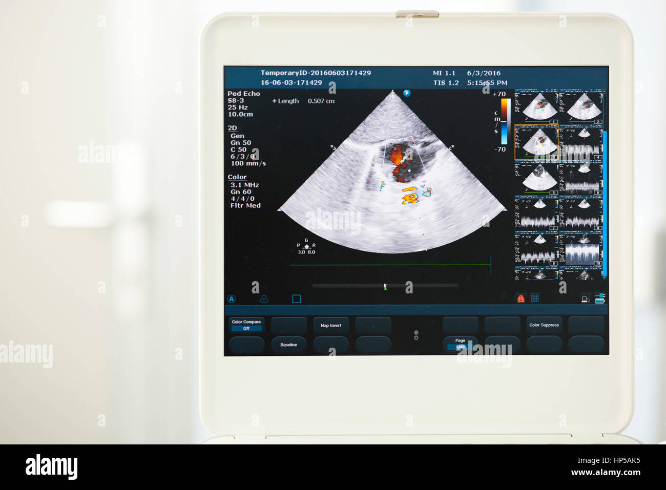 ultrasound scanner screen Stock Photo - Alamy