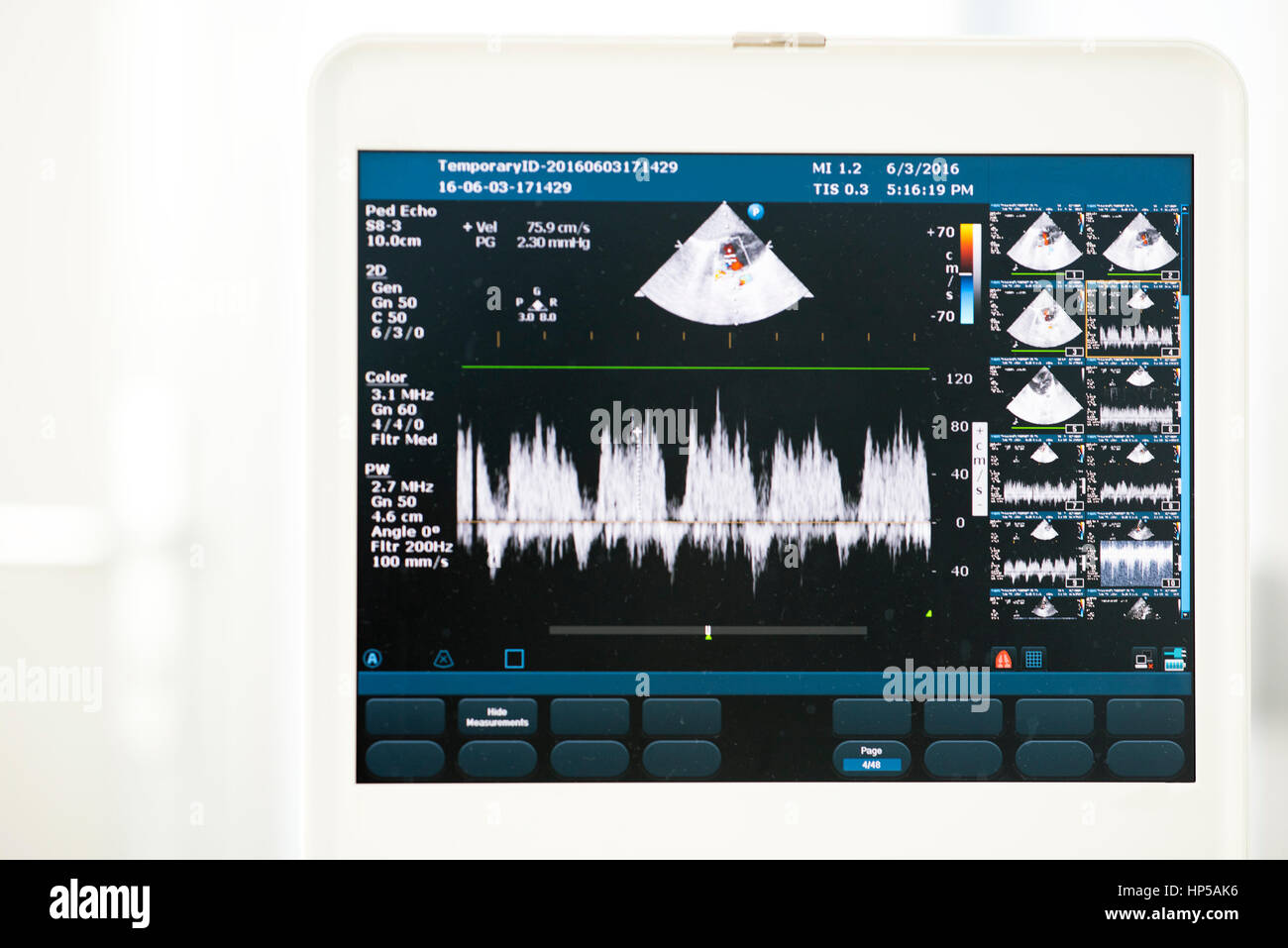 ultrasound scanner screen Stock Photo - Alamy