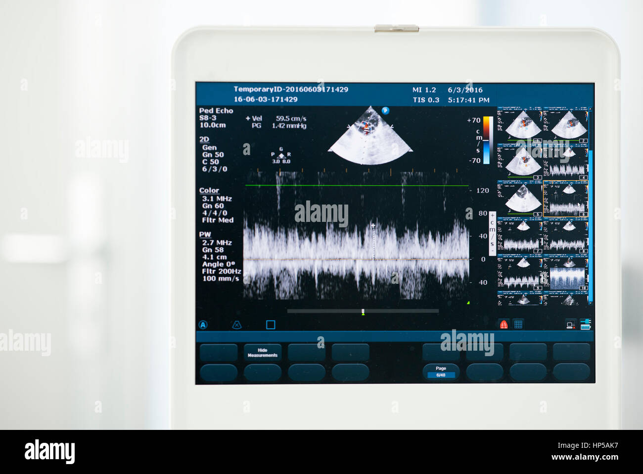 ultrasound scanner screen Stock Photo - Alamy