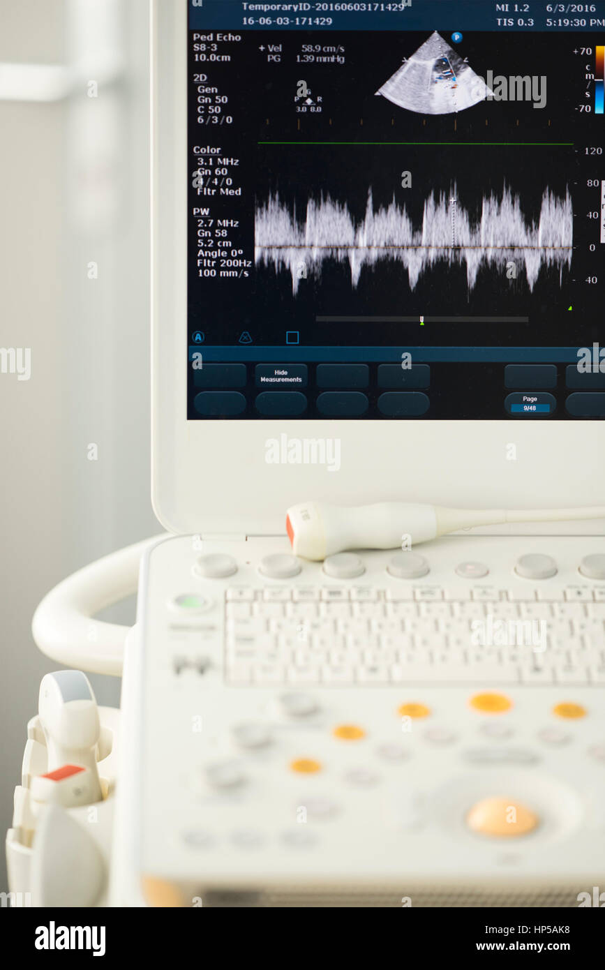 ultrasound scanner screen Stock Photo - Alamy