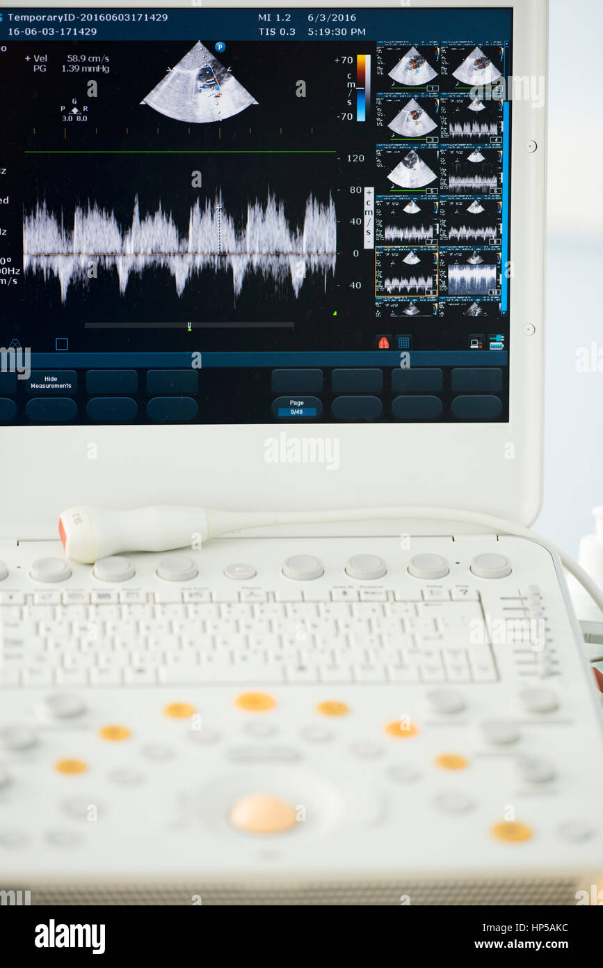 ultrasound scanner screen Stock Photo - Alamy