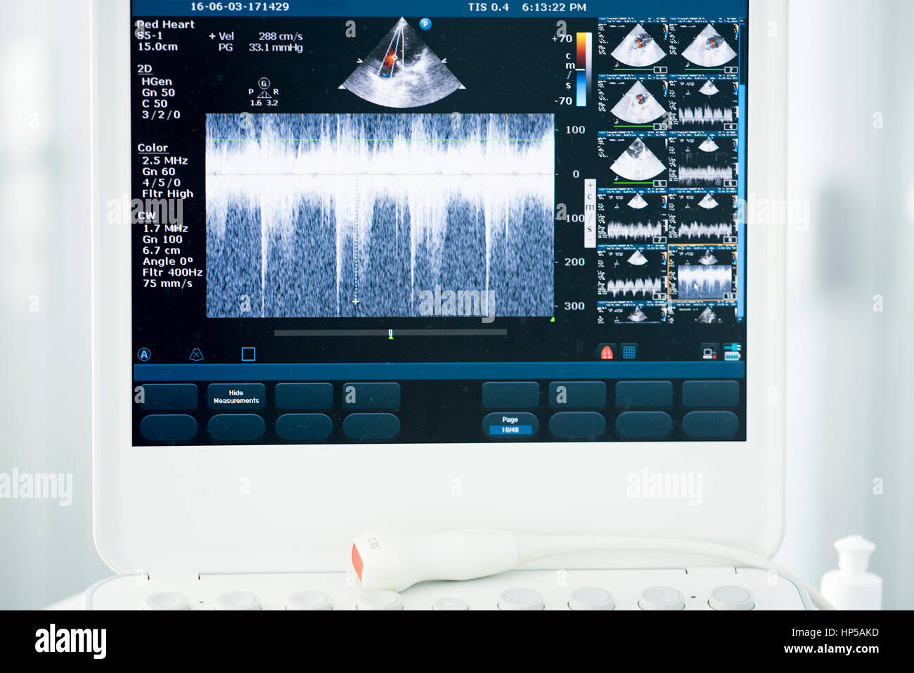 ultrasound scanner screen Stock Photo - Alamy
