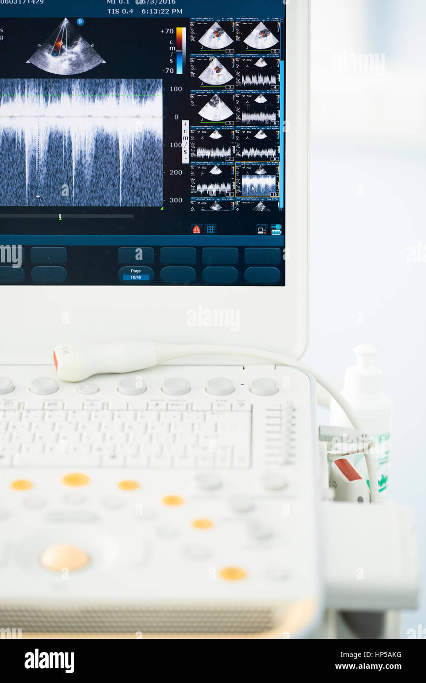 ultrasound scanner screen Stock Photo - Alamy