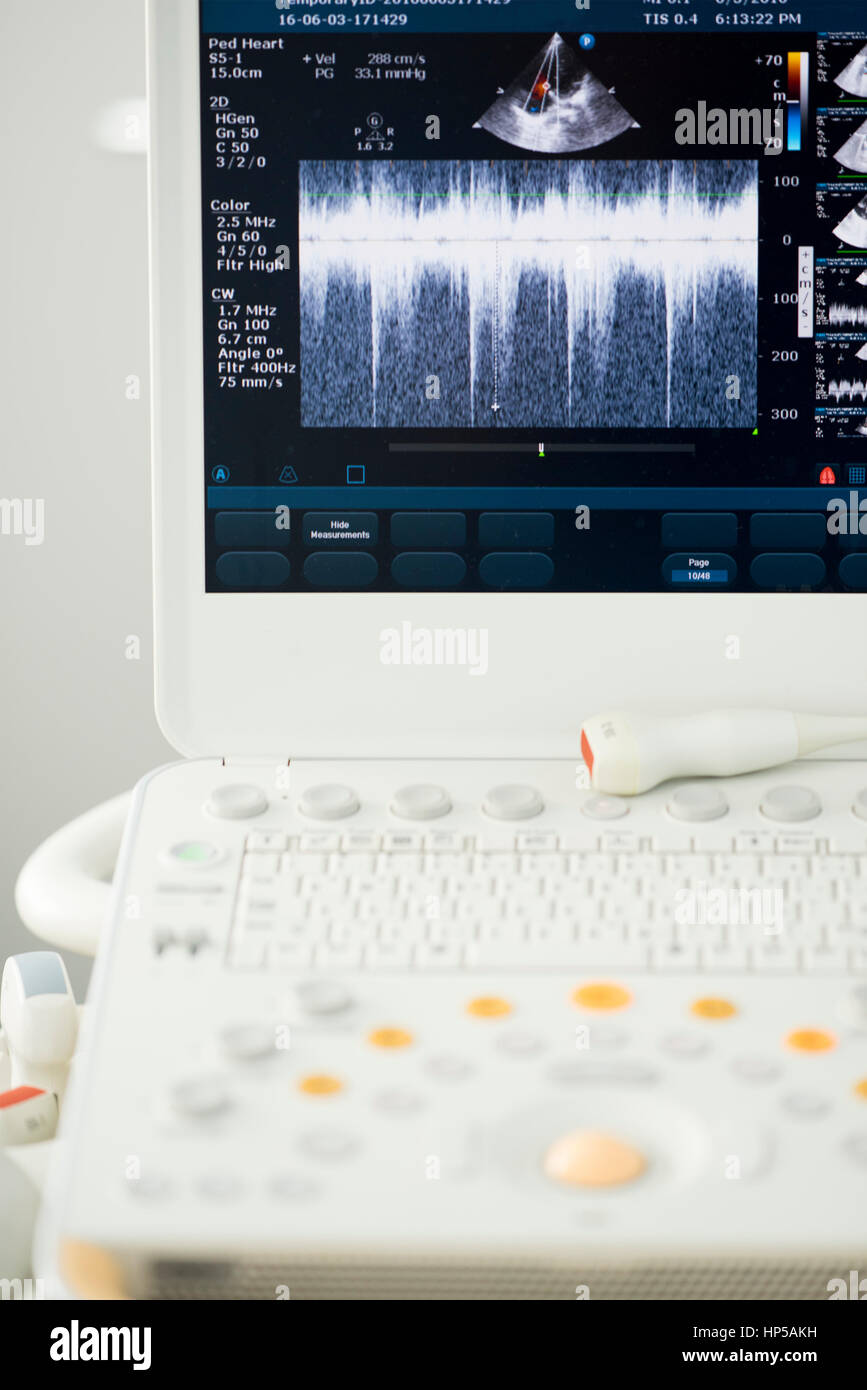 Three dimensional ultrasound hi-res stock photography and images - Alamy