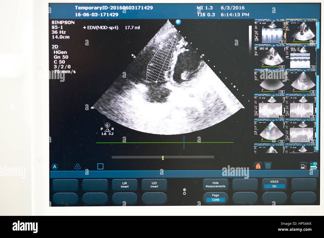 ultrasound scanner screen Stock Photo - Alamy