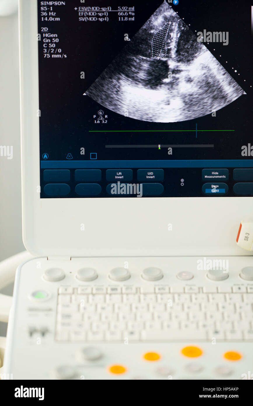 Three dimensional ultrasound hi-res stock photography and images - Alamy