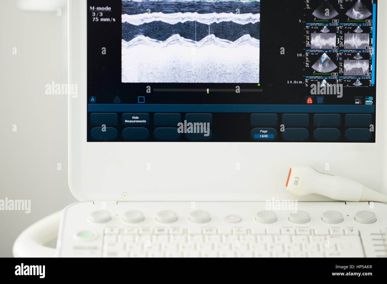 ultrasound scanner screen Stock Photo - Alamy