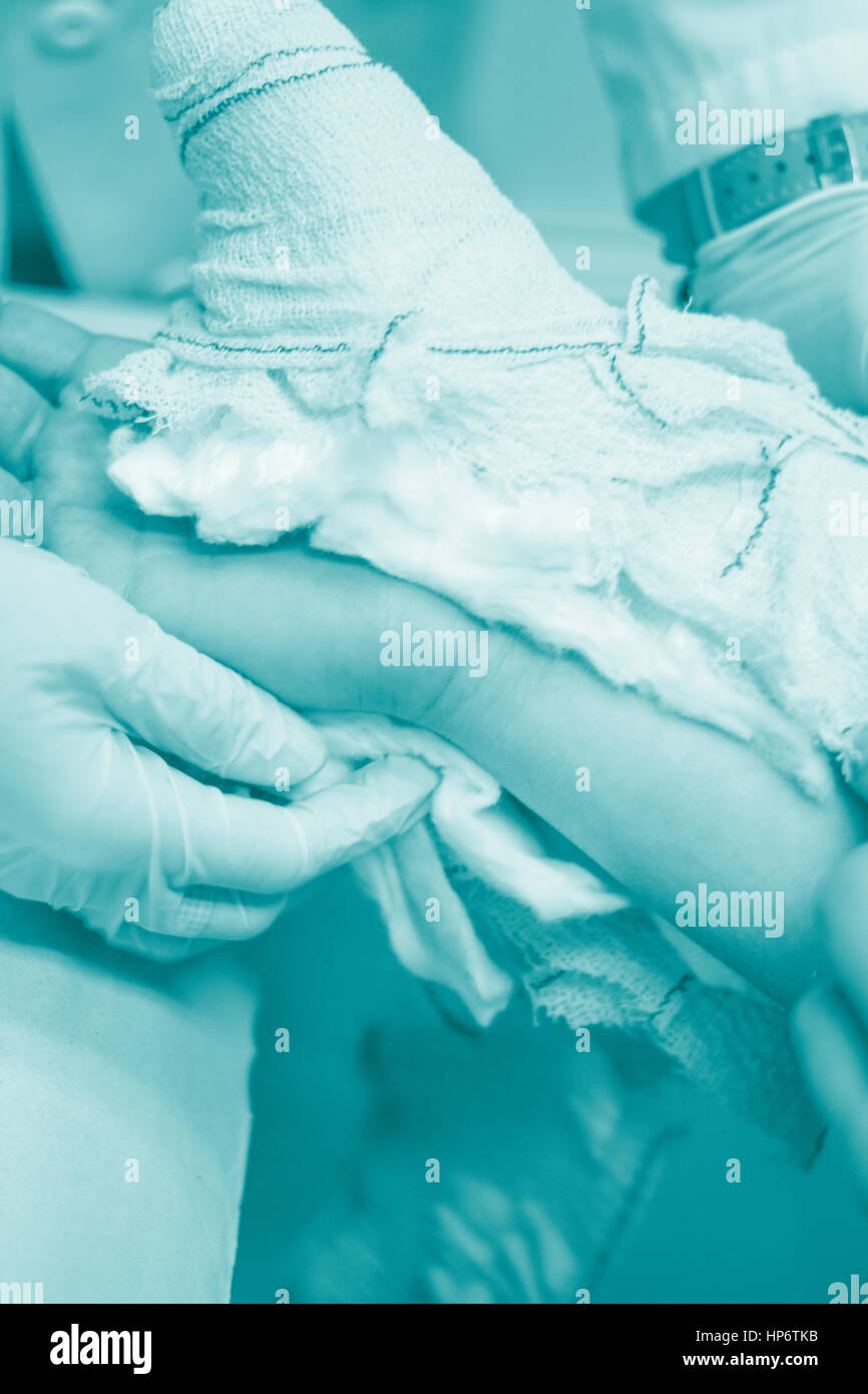 Doctor removing a plaster cast and bandages to patient forearm and ...