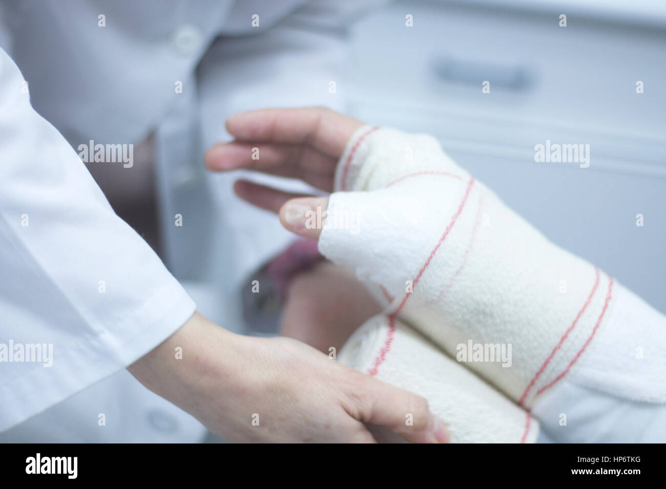 Doctor applying a plaster cast and bandages to patient forearm and ...
