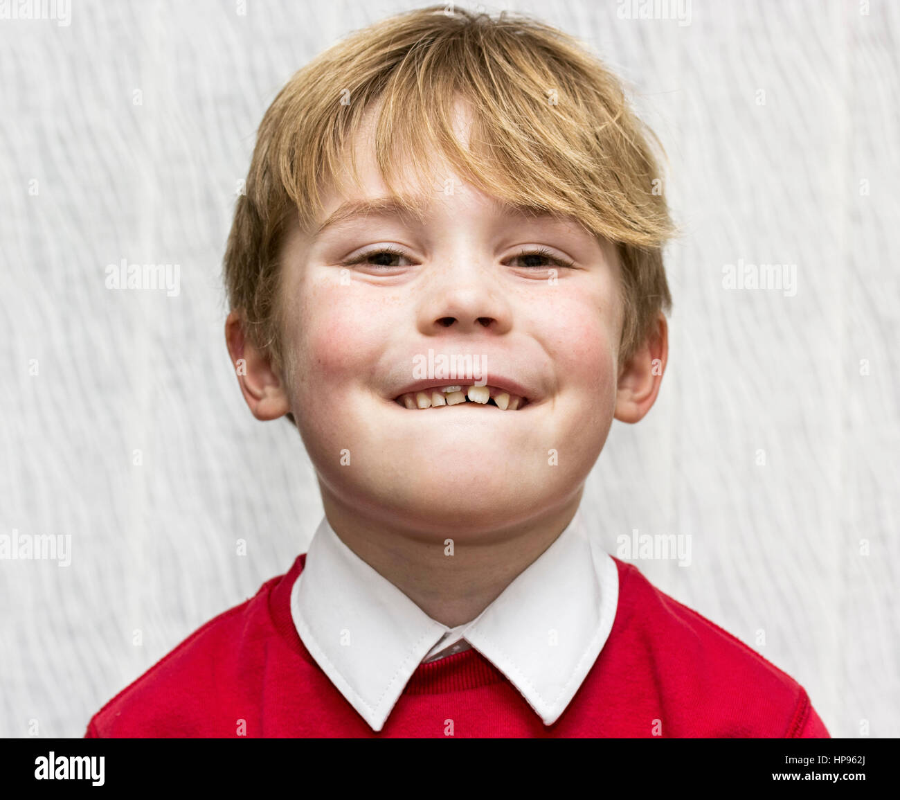 Permanent tooth eruption in an eight year old boy Stock Photo - Alamy