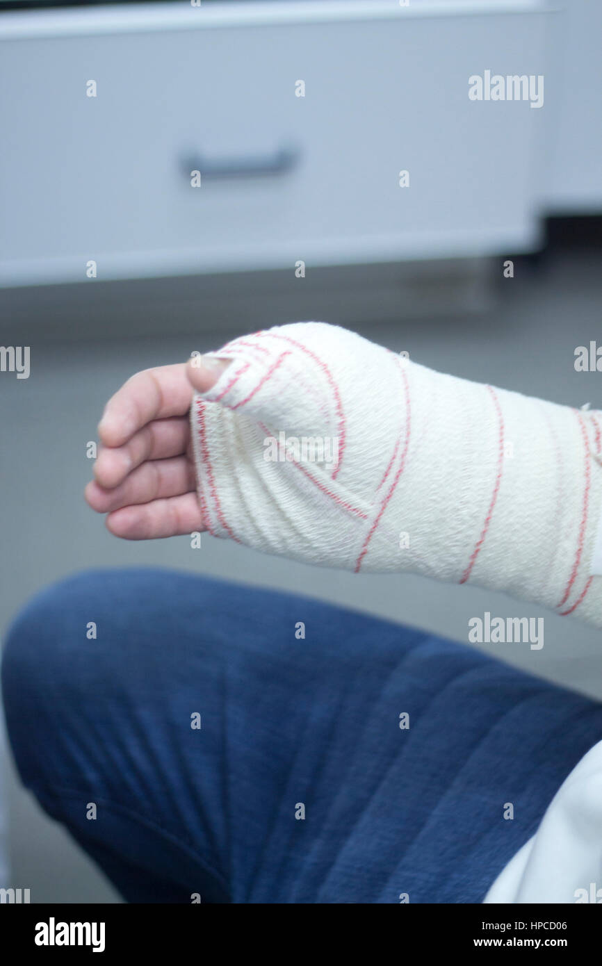 Doctor applying a plaster cast and bandages to patient forearm and ...