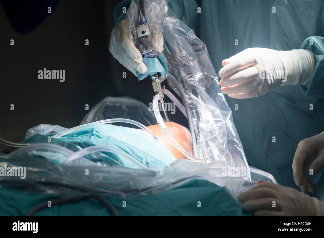 Knee keyhole surgery hospital arthroscopy operation medical procedure ...