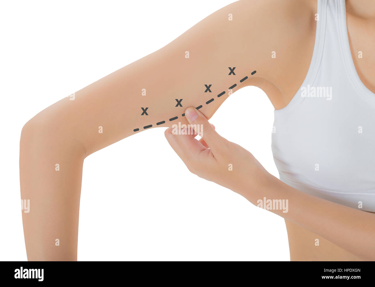 woman grabbing skin on her upper arm with the black color crosses ...