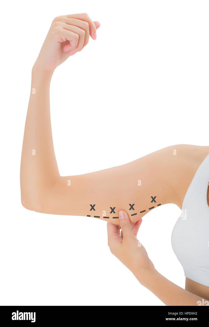 woman grabbing skin on her upper arm with the black color crosses ...