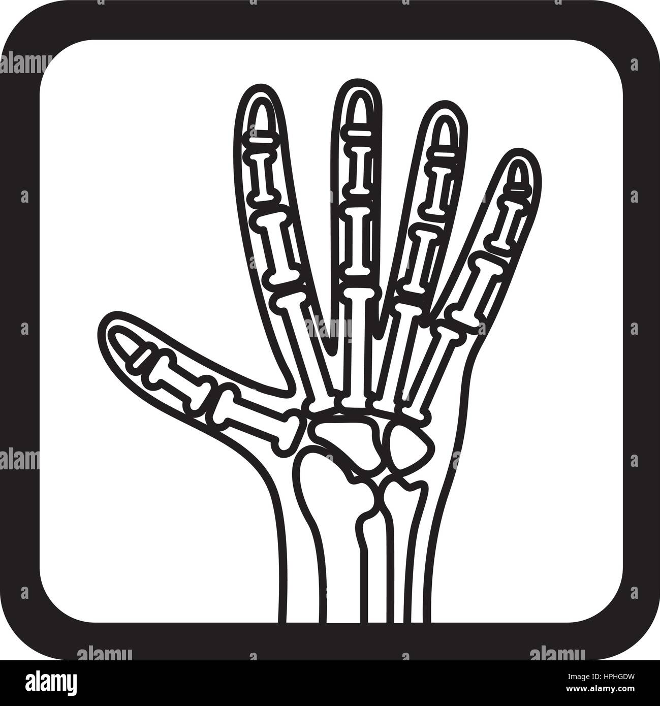 Hand X Ray Clipart