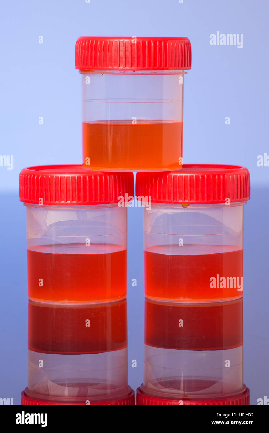 Three urine sample tube isolated on a shiny black blue background Stock ...