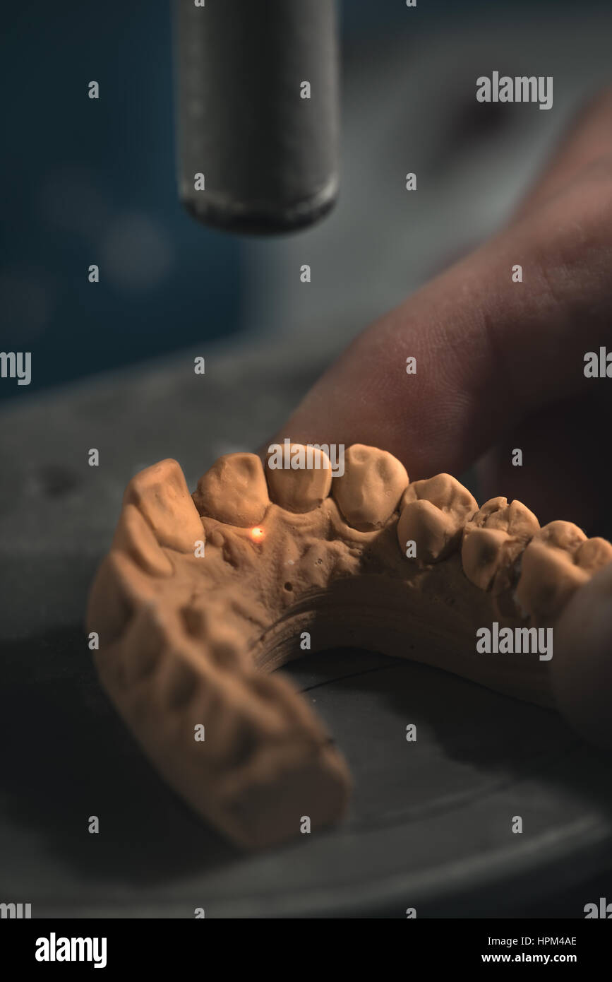 Dental prosthesis, artificial tooth, prosthetic, hands working on the ...