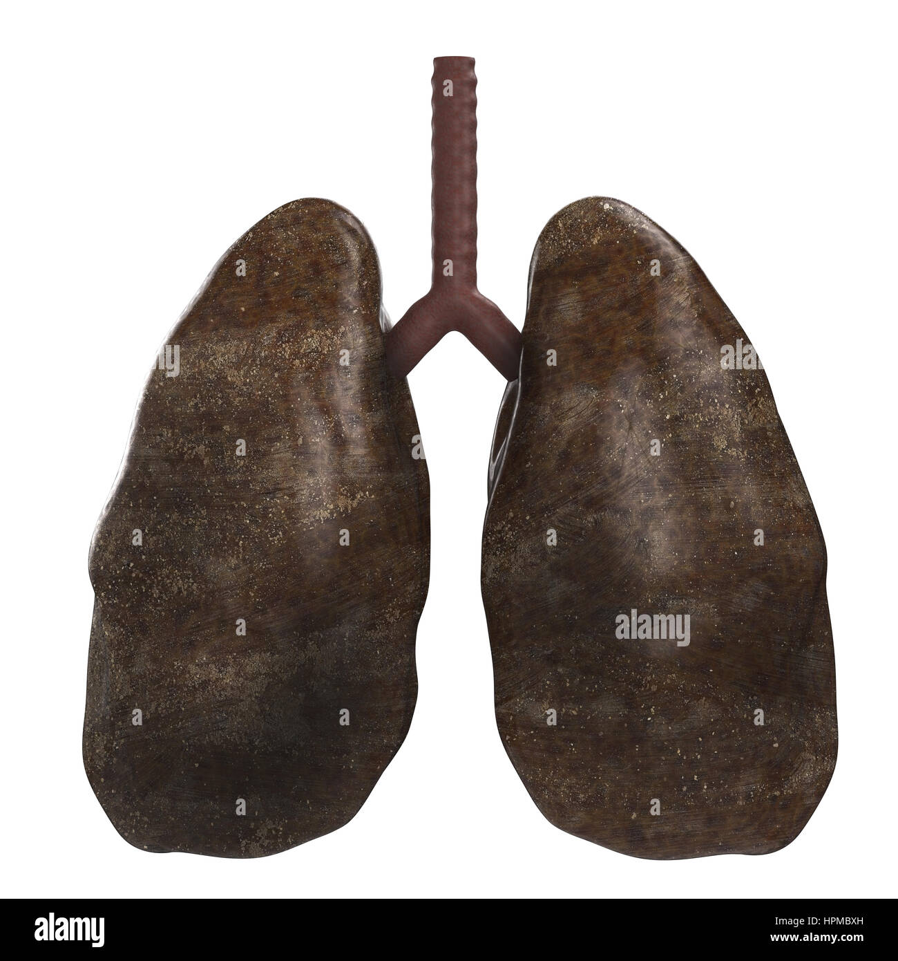 Unhealthy Lung
