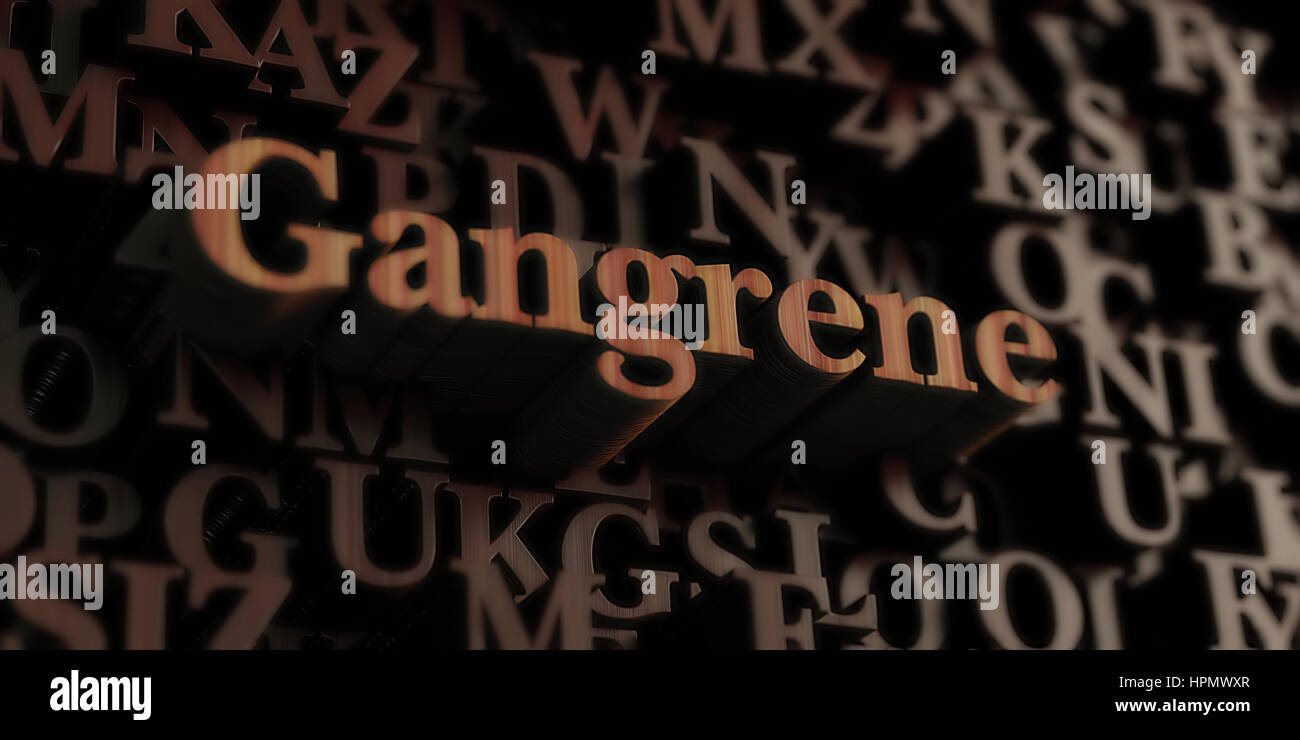 Gangrene hi-res stock photography and images - Alamy