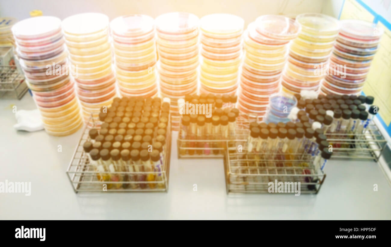 Abstract blur as background of Specimen blood tube and blood agar in ...