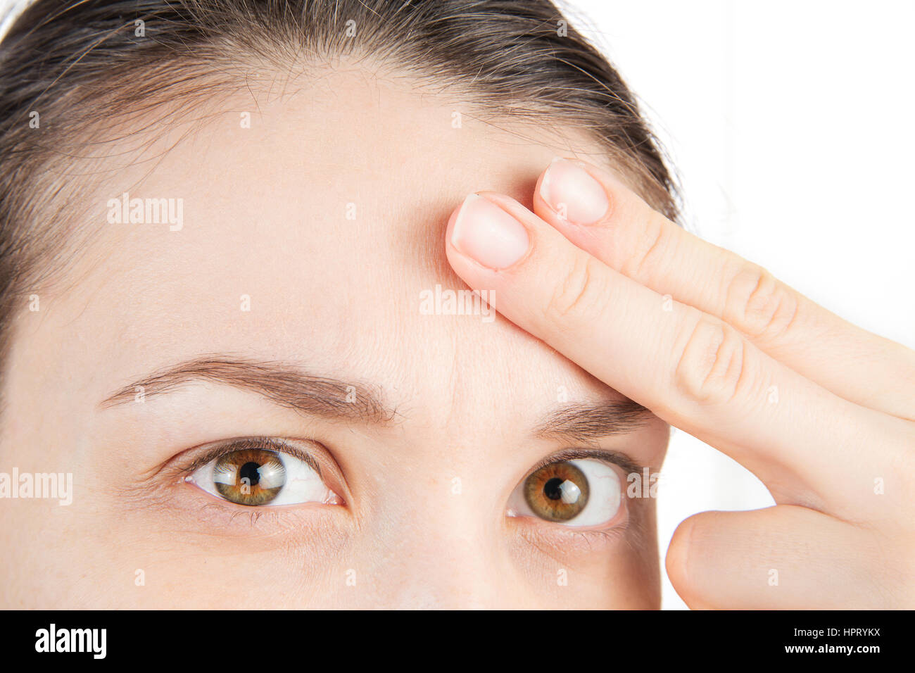 Young women with problem skin and wrinkles on the face Stock Photo - Alamy