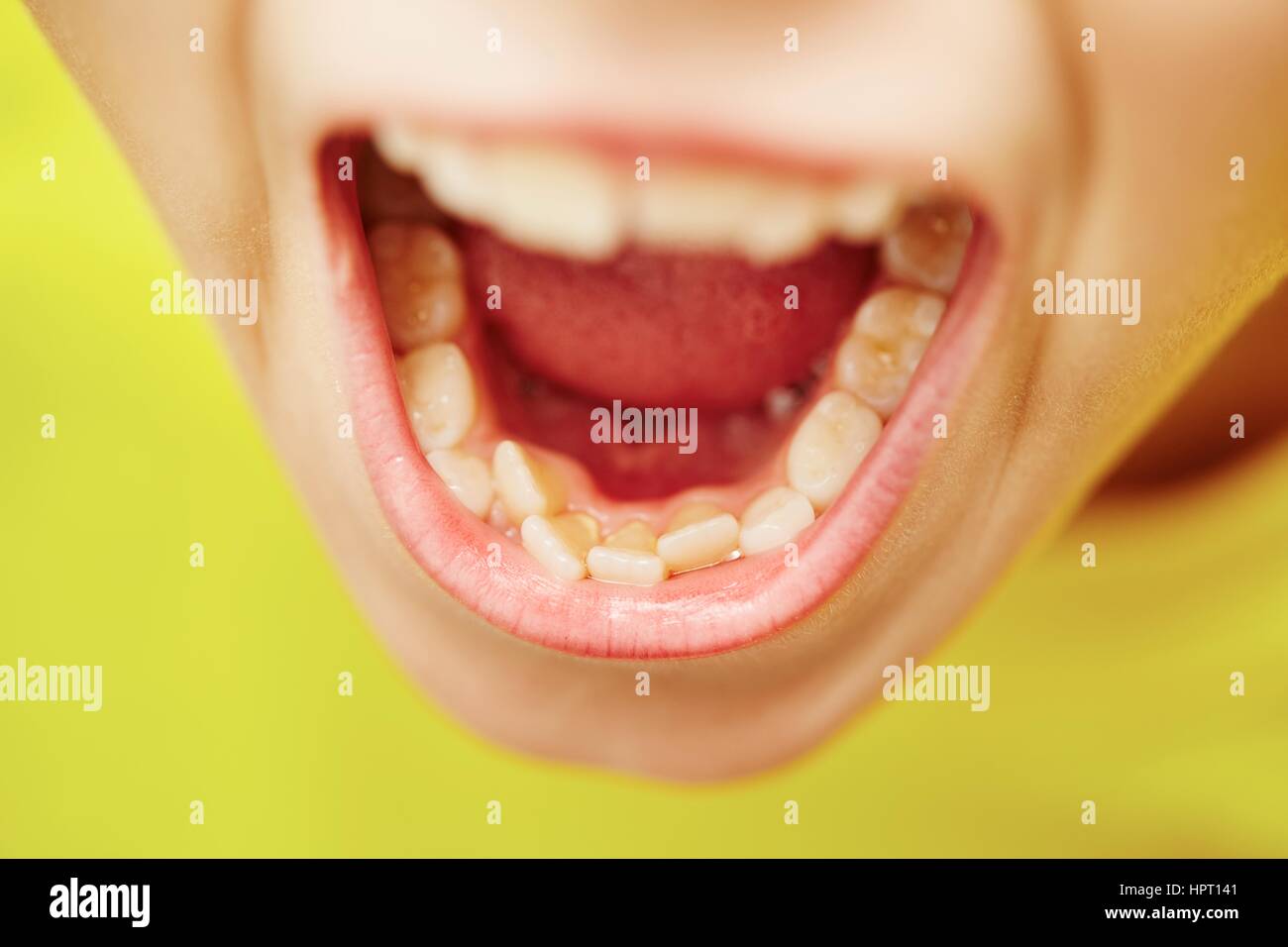 Overlapping teeth hi-res stock photography and images - Alamy