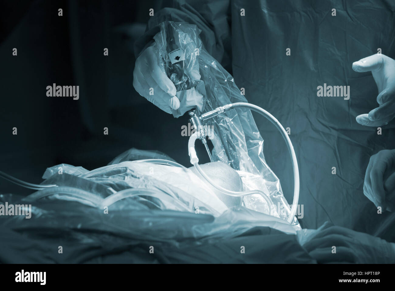 Knee keyhole surgery hospital arthroscopy operation medical procedure ...