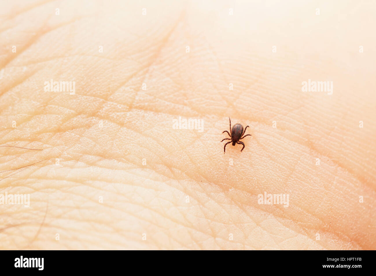 Tick crawling on human skin hi-res stock photography and images - Alamy