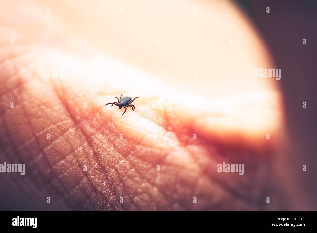 Tick is crawling on the human palm Stock Photo - Alamy