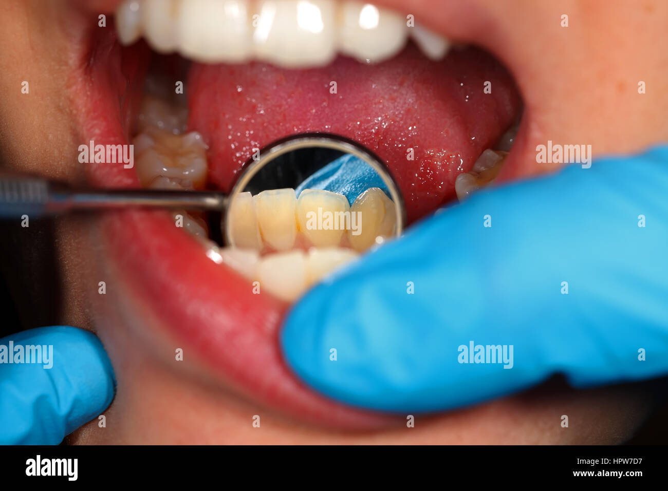 Biofilm people hi-res stock photography and images - Alamy